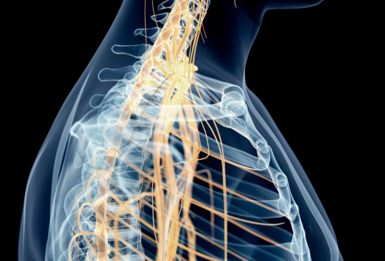 Plesso brachiale: che cos’è e quali sono le sue lesioni più frequenti ...